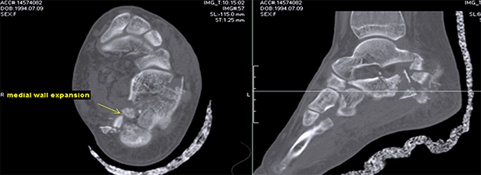 The Orthopaedic Journal at Harvard Medical School | Article