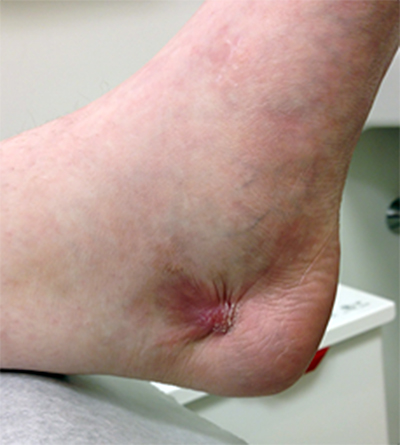 The Orthopaedic Journal at Harvard Medical School | Article